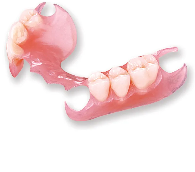 Lower Partial Dentures